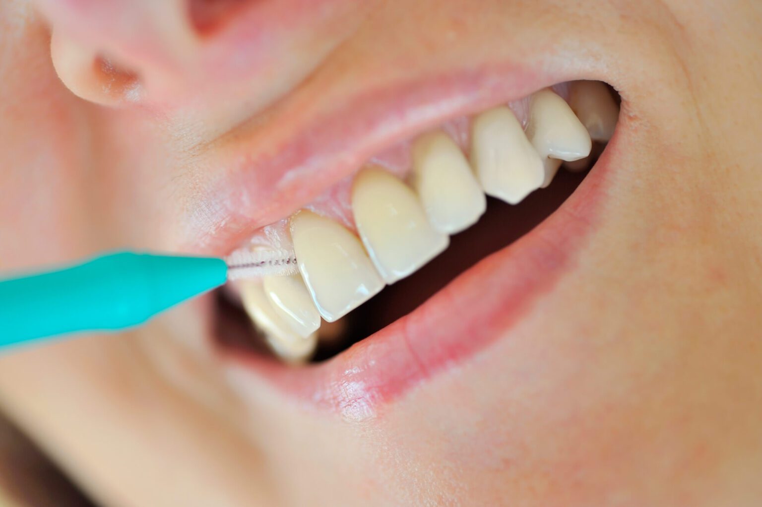 What’s an Interdental Brush and Why Do You Need One? - Smooth Sailing ...